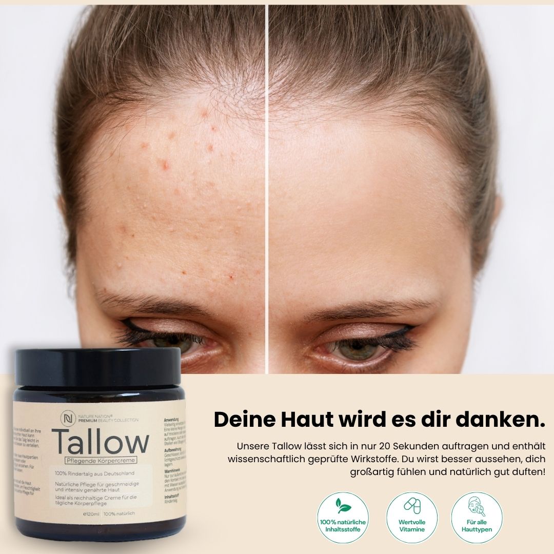Tallow Natur - 100% Rindertalg Creme | Weidehaltung aus Deutschland ...